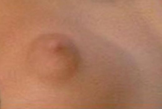 Guess That Celebrity Nipple 1032017